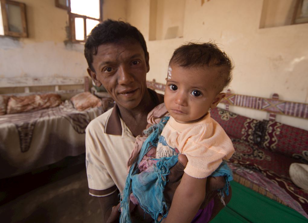 The Manchester Charity Turning back the Tide in Yemen - About Manchester
